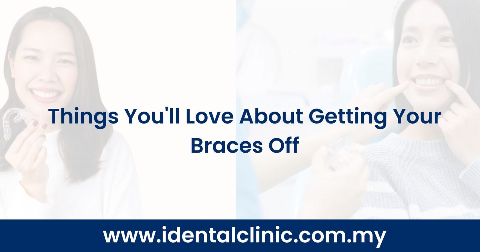 Things You'll Love About Getting Your Braces Off - iDental Clinic